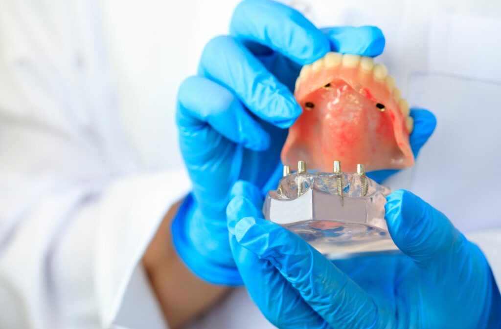 How to get teeth fixed in Turkey | Dentatur