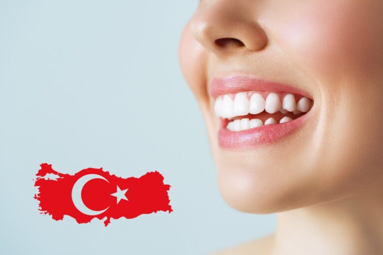 Teeth Whitening in Turkey | Prices - Dentatur