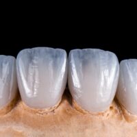 Dental Holiday in Turkey: Teeth Package Deals, Costs, Hotels