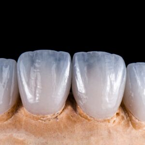 Dental Holiday in Turkey: Teeth Package Deals, Costs, Hotels