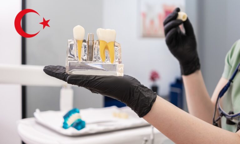 Teeth Replacement Turkey | Dental Implants in Turkey