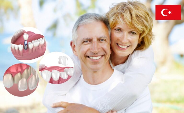 How Much to Get Your Teeth Done in Turkey? – Dentatur