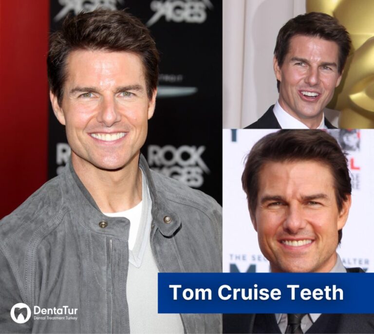 Tom Cruise Teeth How He Got His Famous Hollywood Smile